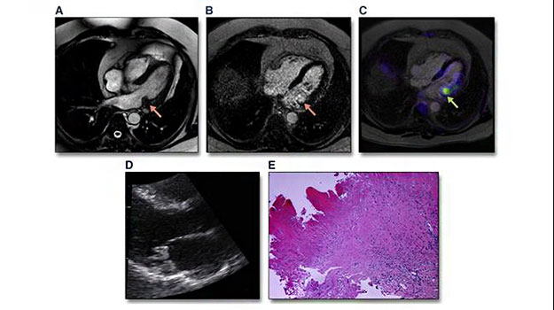 Noninvasive Imaging - American College of Cardiology